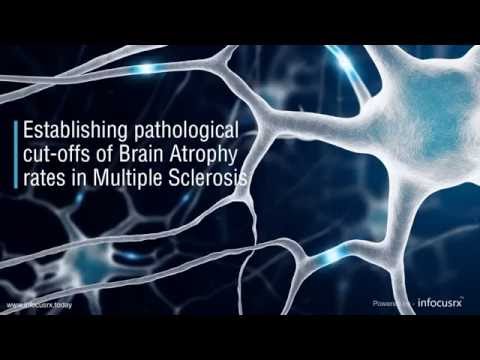 Establishing pathological cut-offs of brain atrophy rates in multiple sclerosis