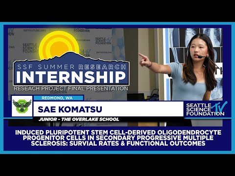 Induced Pluripotent Stem Cell-Derived Oligodendrocyte Progenitor Cells In Secondary MS - Sae Komatsu