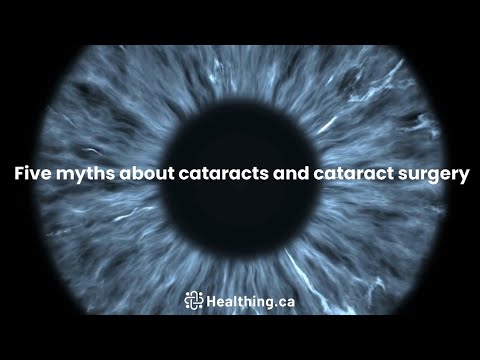 Five myths about cataracts and cataract surgery | Healthing.ca