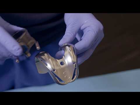 Truliant Knee Modular Femoral Trial Assembly Video