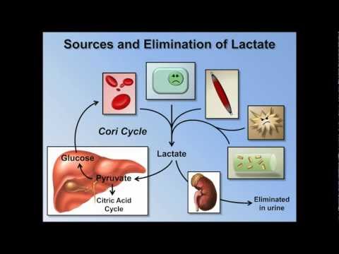 Elevated Anion Gap Metabolic Acidosis (ABG Interpretation - Lesson 8)