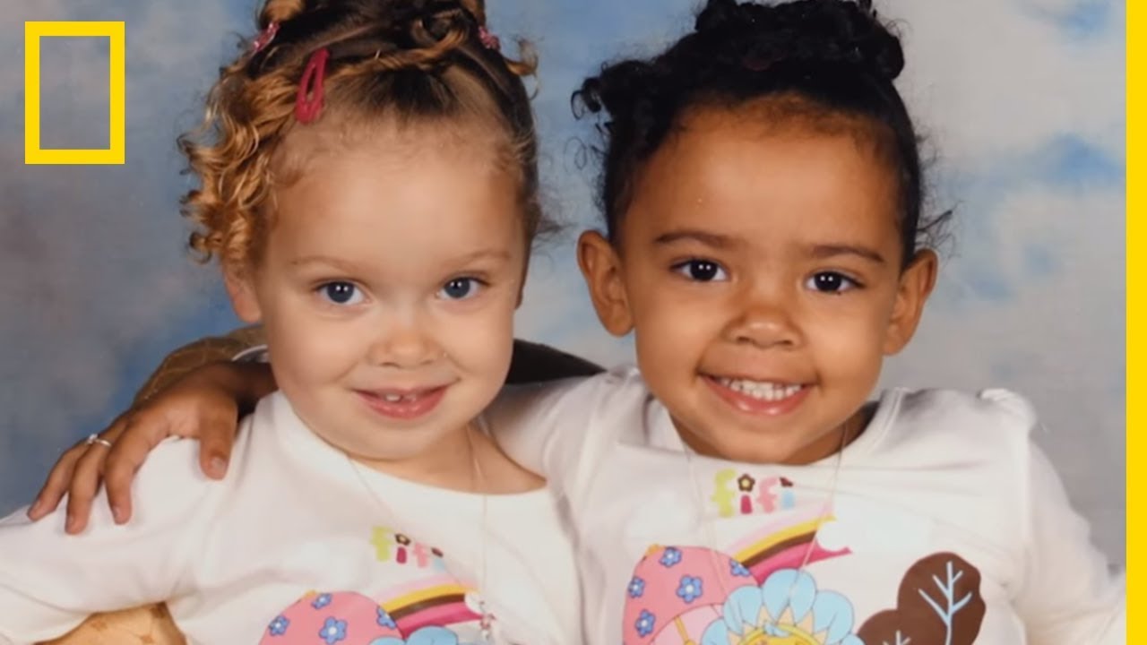 Ces jumelles sont la preuve que la notion de races n'existe pas