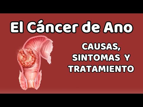 EL CÁNCER DE ANO, Causas, signos y síntomas, diagnóstico y tratamiento
