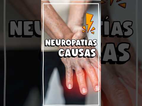 ¡Cuidado! ¿Qué son las neuropatías y cuáles son sus principales causas? #shorts