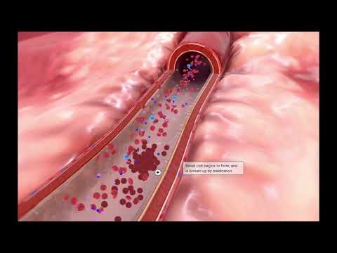 Anti-platelet Agents and Dual Antiplatelet Therapy