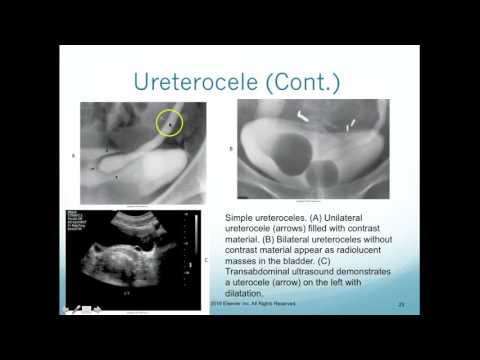 RADT 231 Urinary