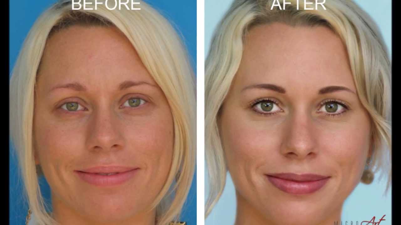 Before and after photos of MicroArt™ Semi Permanent Makeup