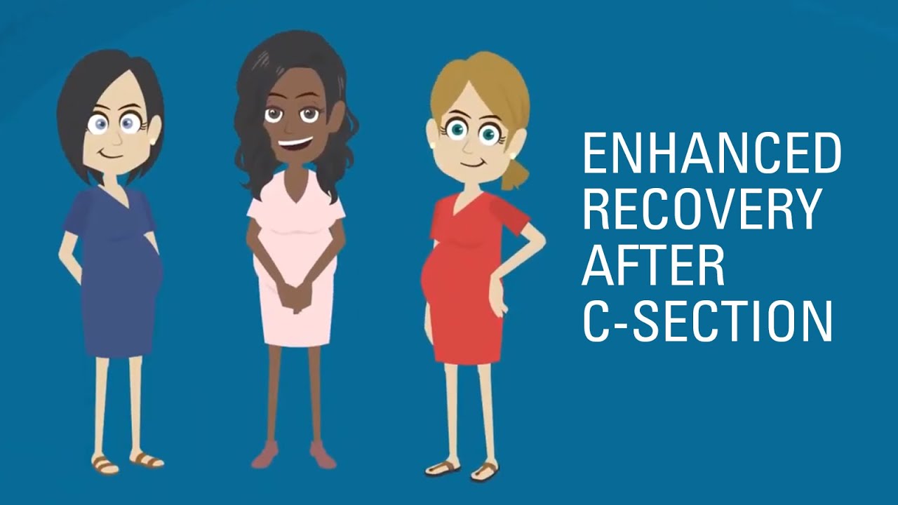 Improving C-Section Recovery: The ERAS Program Helps You Heal