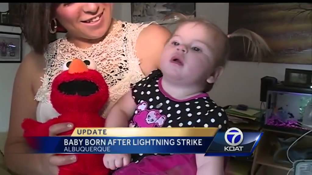 Meet miracle baby 'Flash' who survived being struck by LIGHTNING while ...