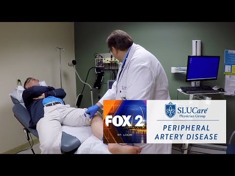 Leg Pain Could Signal Peripheral Artery Disease - SLUCare Health Watch