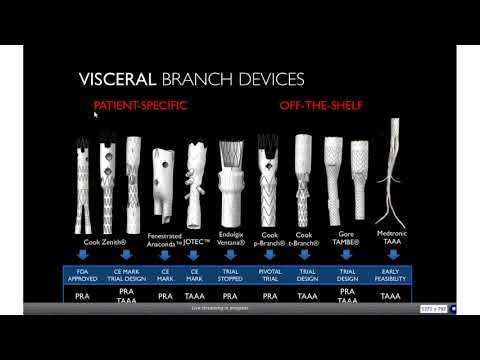 FEVAR / BEVAR Tips and Tricks: From Sizing to Implantation and Evaluation