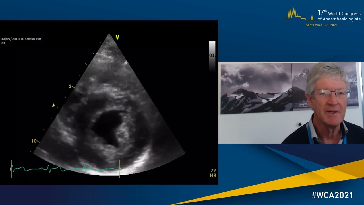 The Parturient With Preeclampsia