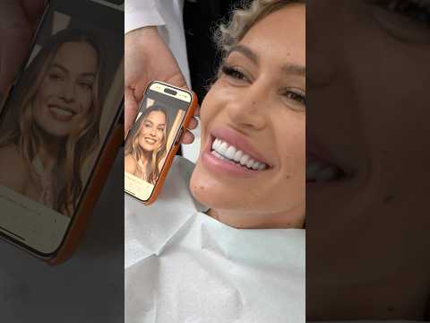 Veneer Transformation, Just like Margot Robbie's! #hollywoodsmile #veneers #dentalshorts
