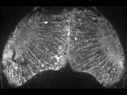 Visualizing Brain Activity of A Fish