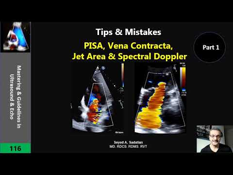 Tips & Mistakes: PISA, Vena Contracta ...