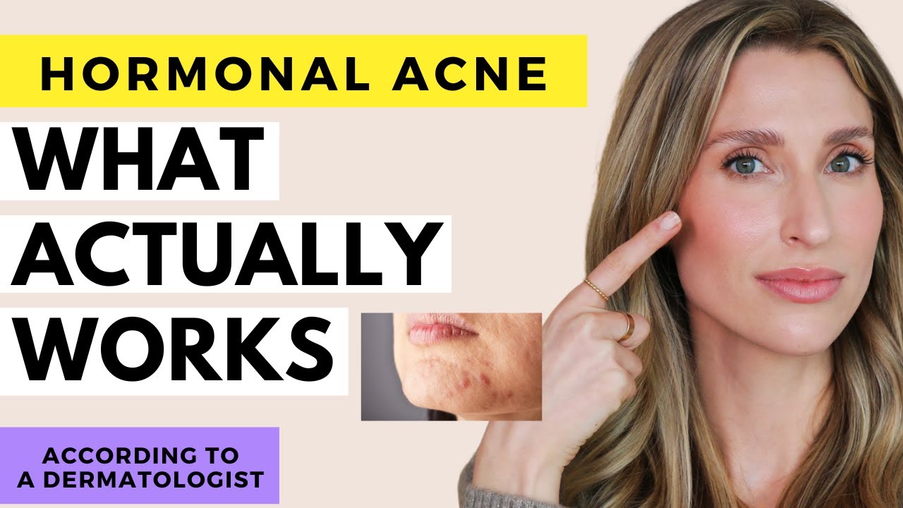 Fix Hormonal Acne For REAL | Dr. Sam Ellis