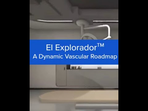 Dynamic Roadmap for Interventional Vascular Applications