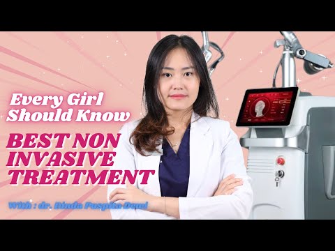 BEST NON INVASIVE TREATMENT : FRAXIS DUO FOR COMBINATION OF FRACTIONAL LASER AND RF MICRONEEDLING
