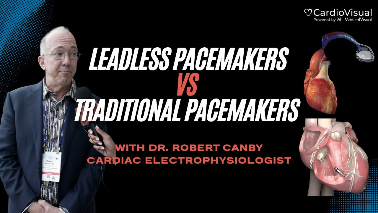 Leadless Pacemakers & the Future of Cardiac Pacing