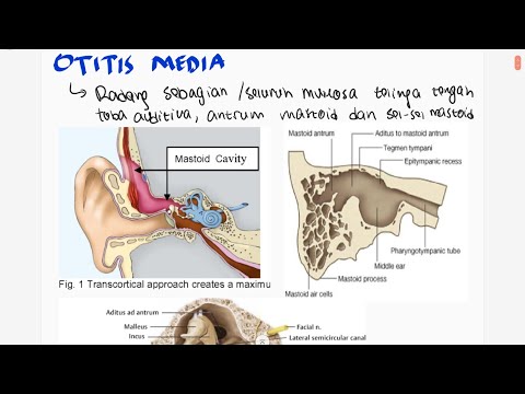 Otitis Media : Klasifikasi dan Patogenesis Secara Umum