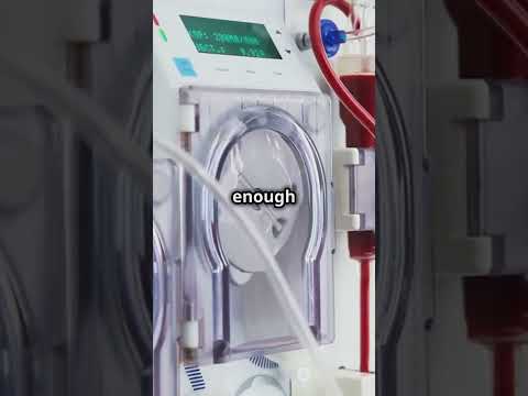 How Kidneys Impact Diabetes Insipidus
