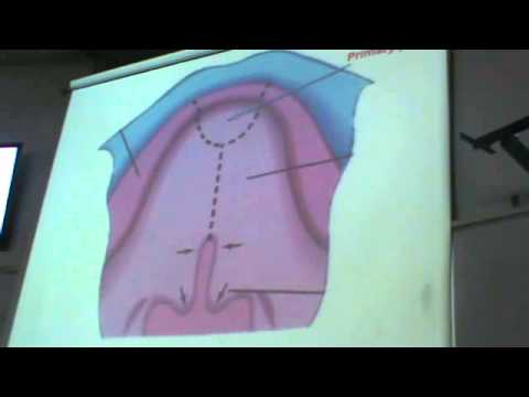 Embryology Dr. Sherif Fahmy 7 - face and tounge