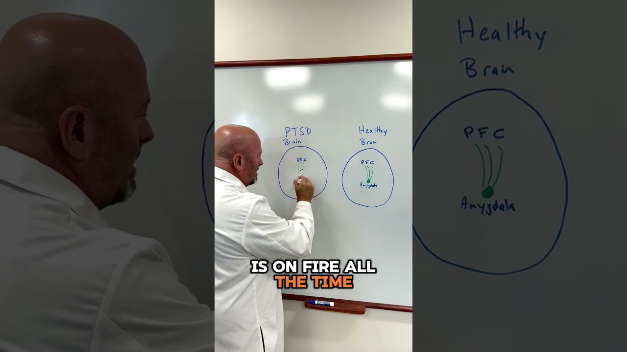 PTSD Brain vs Normal Brain Explained