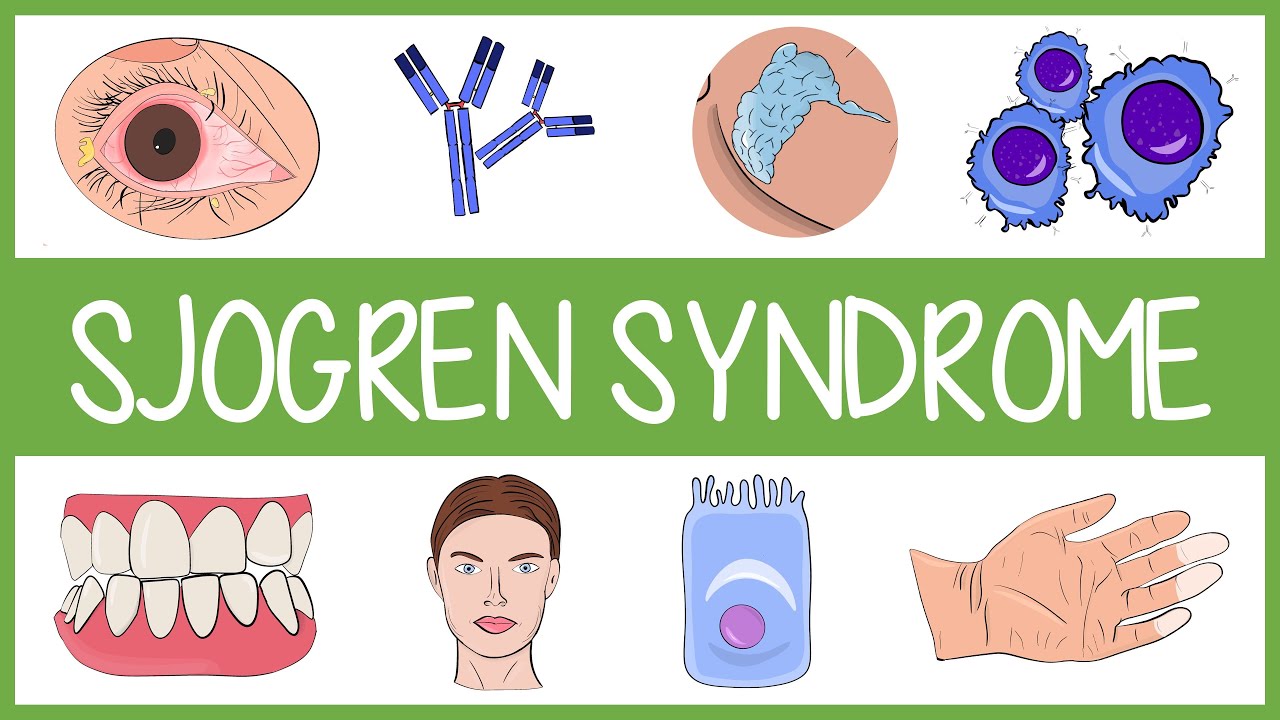 Sjogren Syndrome Visually Explained