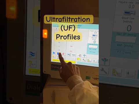 BBraun: Hemodialysis UF (Ultrafiltration) Profiles #dialysismachine #bbraun