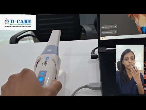 What are intra oral Scanners?