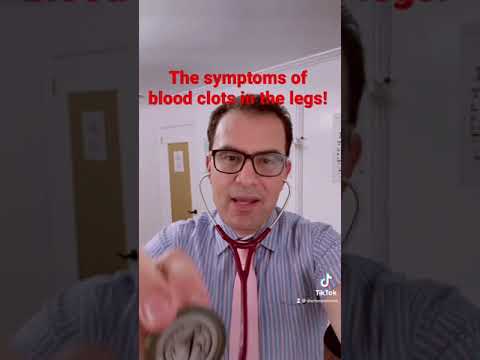 The symptoms of blood clots in the legs!