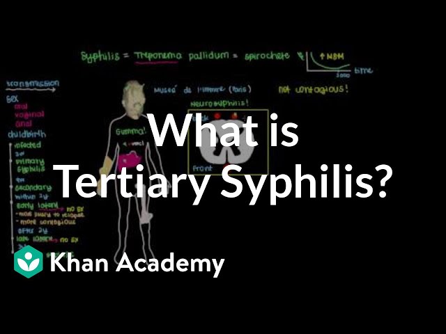 How to pronounce tertiary syphilis | HowToPronounce.com