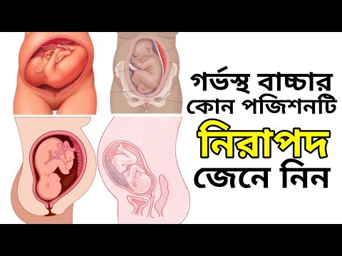 গর্ভাবস্থায় কোন পজিশন নিরাপদ জেনে নিন | Womb Baby position bangla