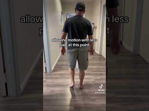 Total ankle replacement wright medical infinity