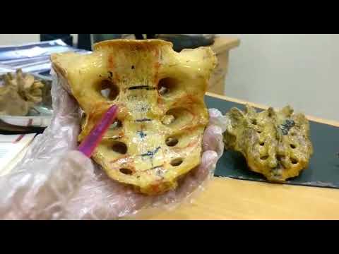 Ala of sacrum