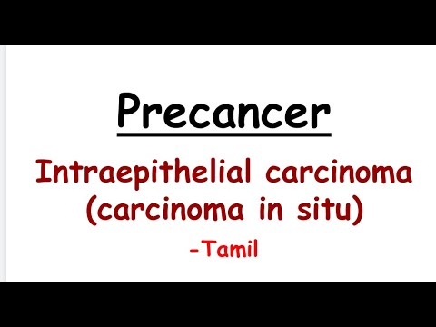 carcinoma in situ (intra epithelial carcinoma)-oral pathology tamil