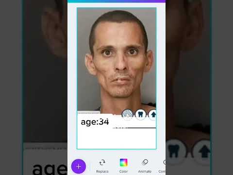 Before and after methamphetamine: extreme cases.