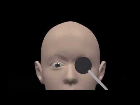EXTRAOCULAR MUSCLES AND EYE MOVEMENTS AND TERMINOLOGY 4TH YR