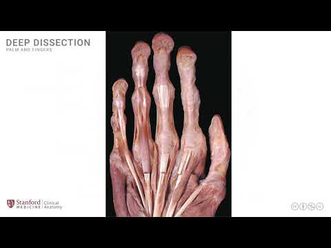 Anatomy of the Upper Limb: Long Flexor Tendons