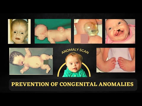 Prevention of Congenital Anomalies in Hindi | DrOzaConnects in Hindi | Dr Nisheeth Oza