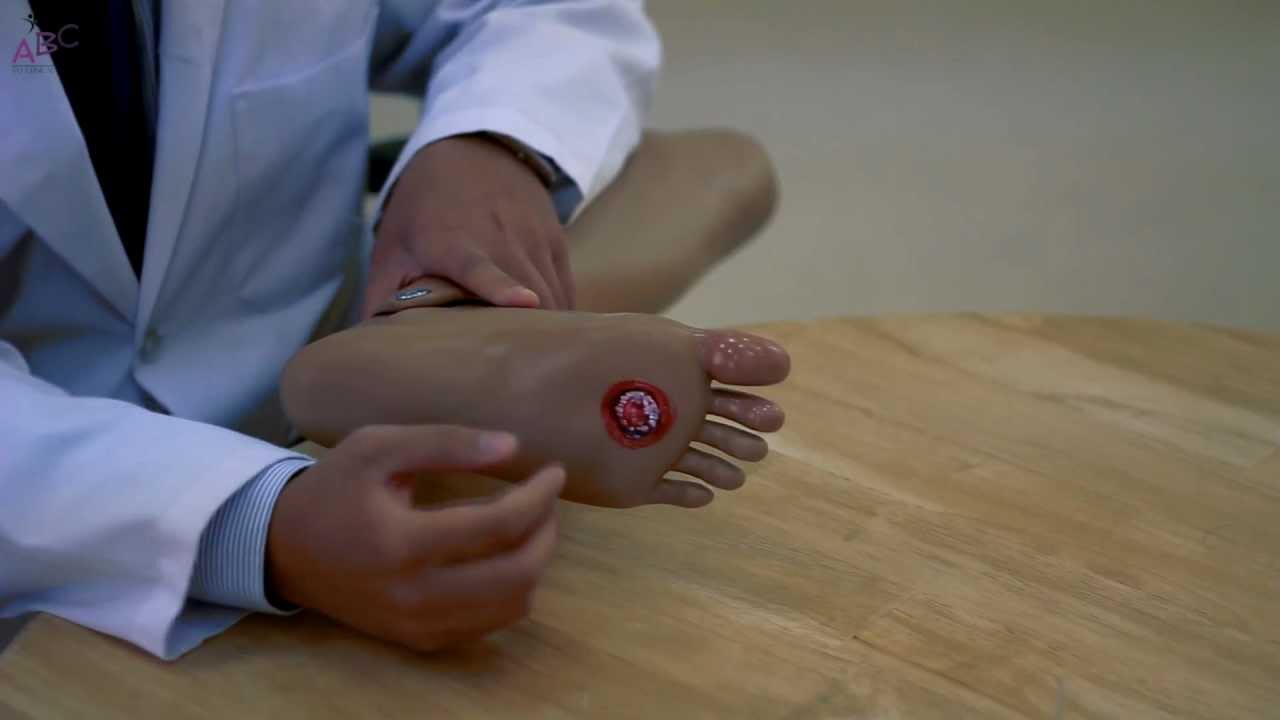 ABC To Clinical - Ulcer Examination