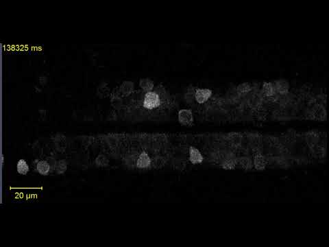 Airyscan Fast Imaging for Calcium Signaling, Part 1