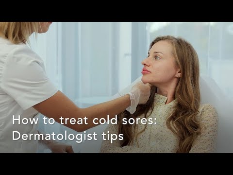 How to treat cold sores: Dermatologist tips