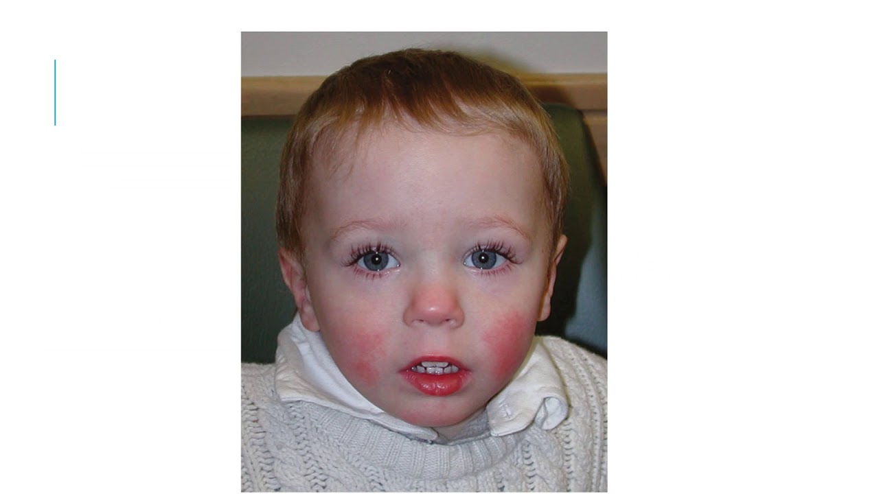 Chapter 25 PPT with Voiceover