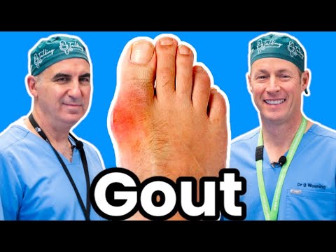 Do You Have Gout? Here's How To Diagnose, Treat and Prevent It