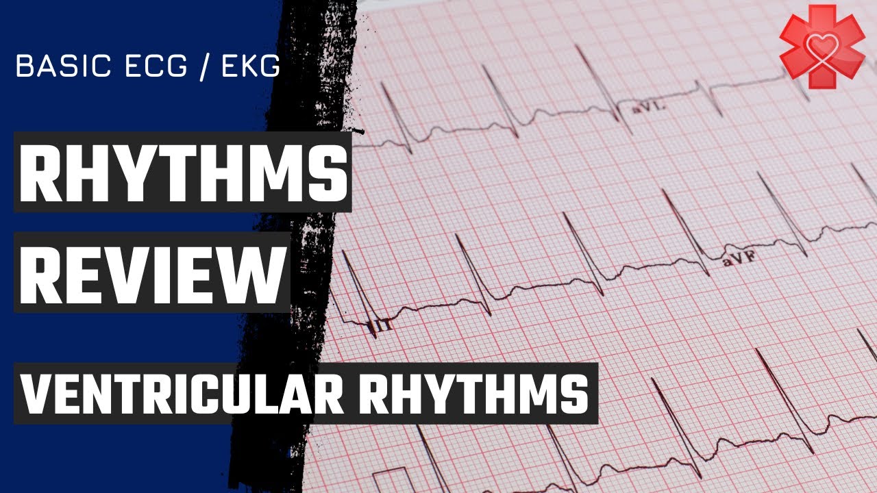 Basic ECG/ EKG Part 4: Ventricular Rhythms