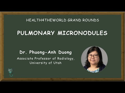 Pulmonary Micronodules Dr Duong