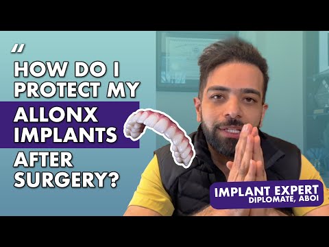 2 KEYS to LESS All on 4 Dental Implant FAILURE