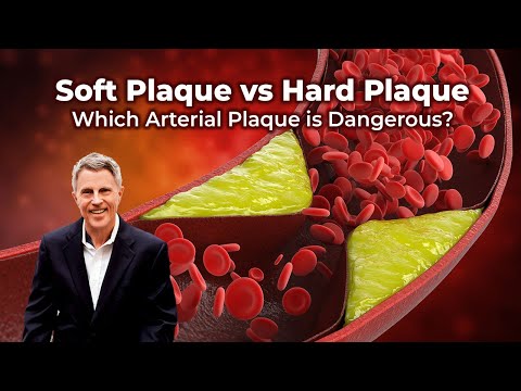 Soft Plaque vs Hard Plaque - Which Arterial Plaque is Dangerous?
