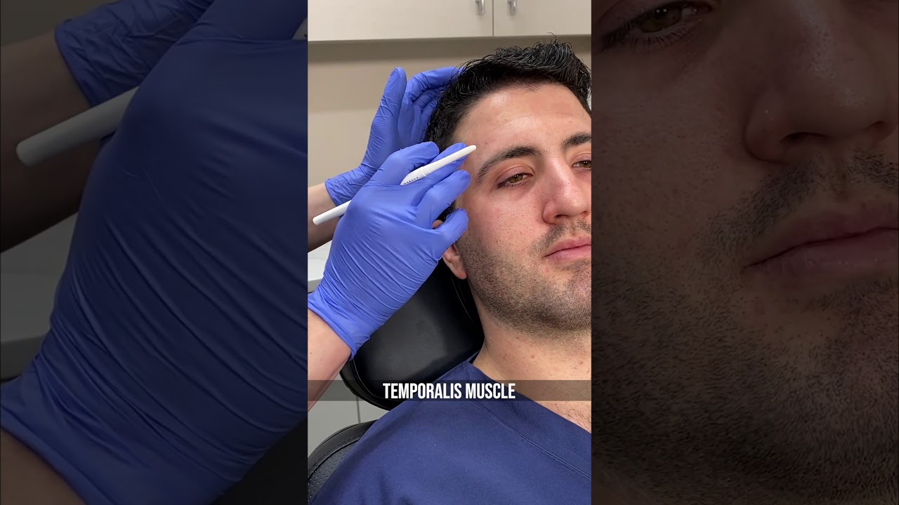 NYC Botox for Men | UES Male Botox Injections | Forehead Wrinkle Reduction | Dr. Gary Linkov